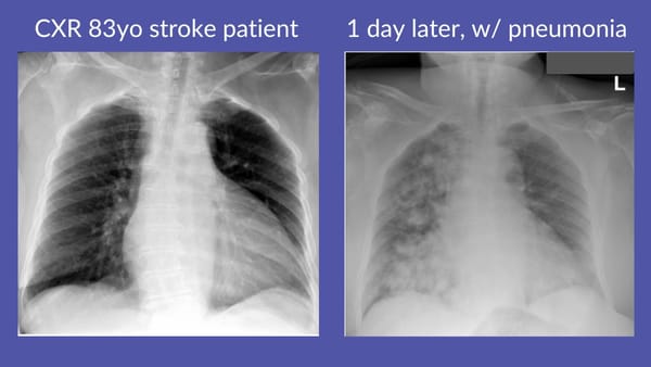 NPO Guidelines for Elective Surgery: What You Need to Know
